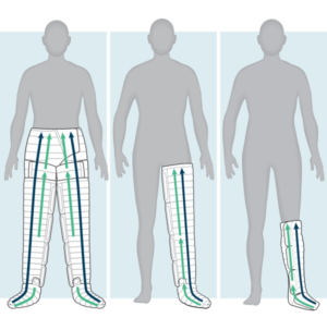 Flexitouch Plus - Treat Lower Body, Leg and Ankle Swelling at Home