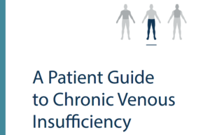 What is Chronic Venous Insufficiency (CVI) A Patient Guide | Tactile Medical