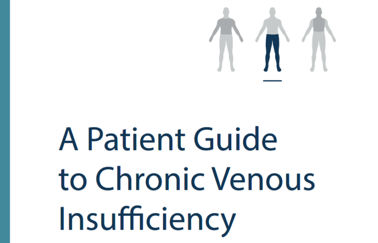 What is Chronic Venous Insufficiency (CVI) A Patient Guide | Tactile ...