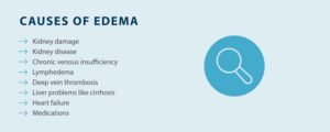 What Happens If Edema Is Left Untreated? - Tactile Medical