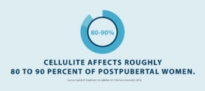 Lipedema vs. Cellulite: What Are the Differences? - Tactile Medical