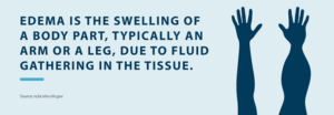 Edema Guide: What Is Edema? - Tactile Medical