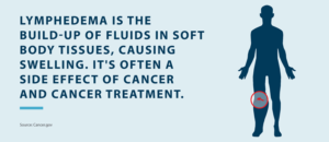 Can Cancer Cause Lymphedema? - Tactile Medical