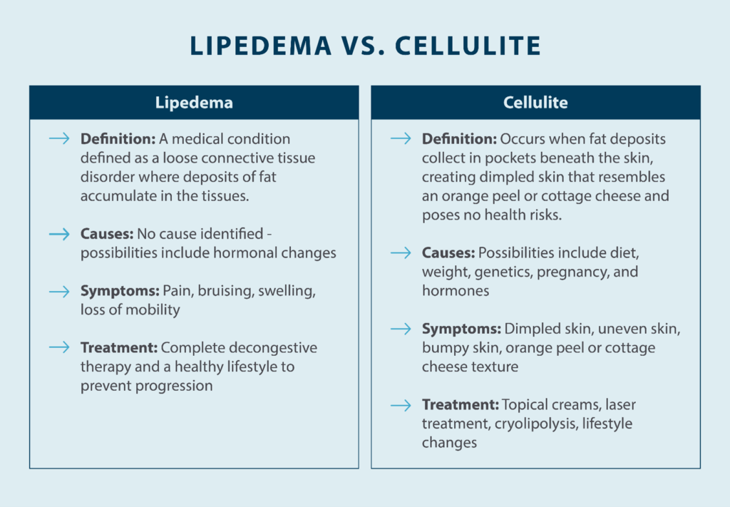 What you Need to Know About Lipedema - Tactile Medical