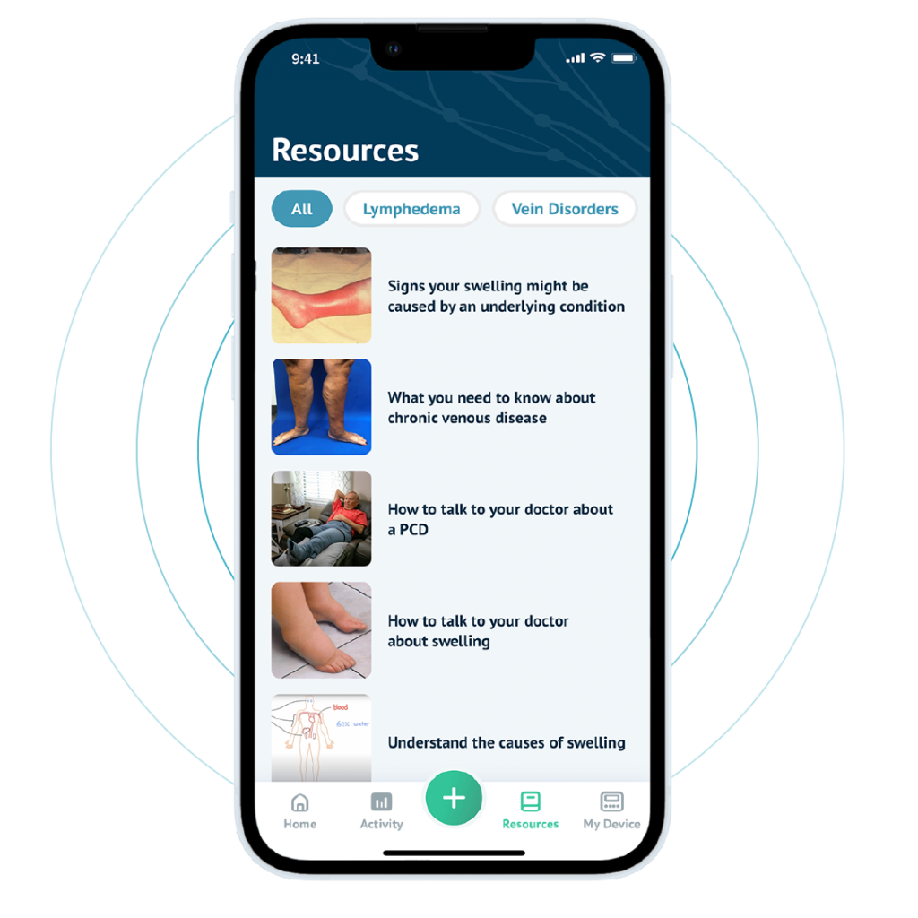 Kylee App: Lymphedema & Chronic Swelling App | Tactile Medical