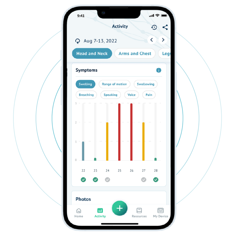 Kylee App: Lymphedema & Chronic Swelling App | Tactile Medical