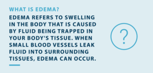 How to Manage Edema After Surgery - Tactile Medical