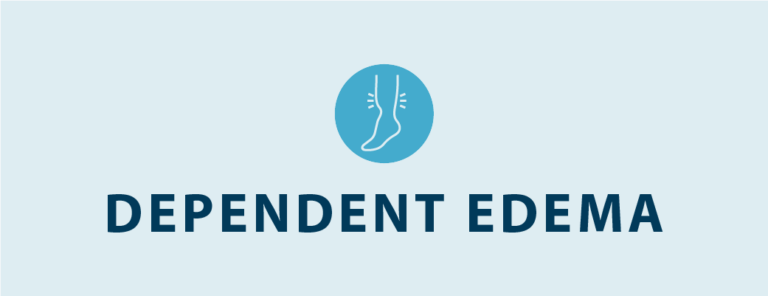 Dependent Edema: Symptoms, Causes, Treatment & More - Tactile Medical
