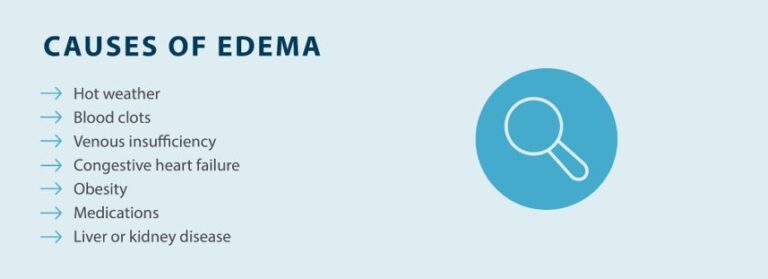 Measuring Edema: How Do You Measure Edema? - Tactile Medical