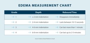 Measuring Edema: How Do You Measure Edema? - Tactile Medical
