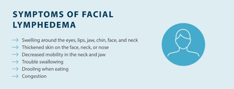 Facial Lymphedema: Treatment, Causes & More - Tactile Medical