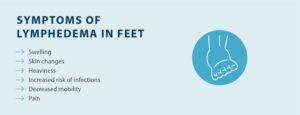 Lymphedema in Feet: Causes, Symptoms & Treatment - Tactile Medical