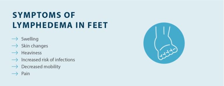 Lymphedema in Feet: Causes, Symptoms & Treatment - Tactile Medical