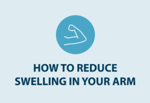 Arm Swelling: How to Reduce Swelling in Your Arm - Tactile Medical