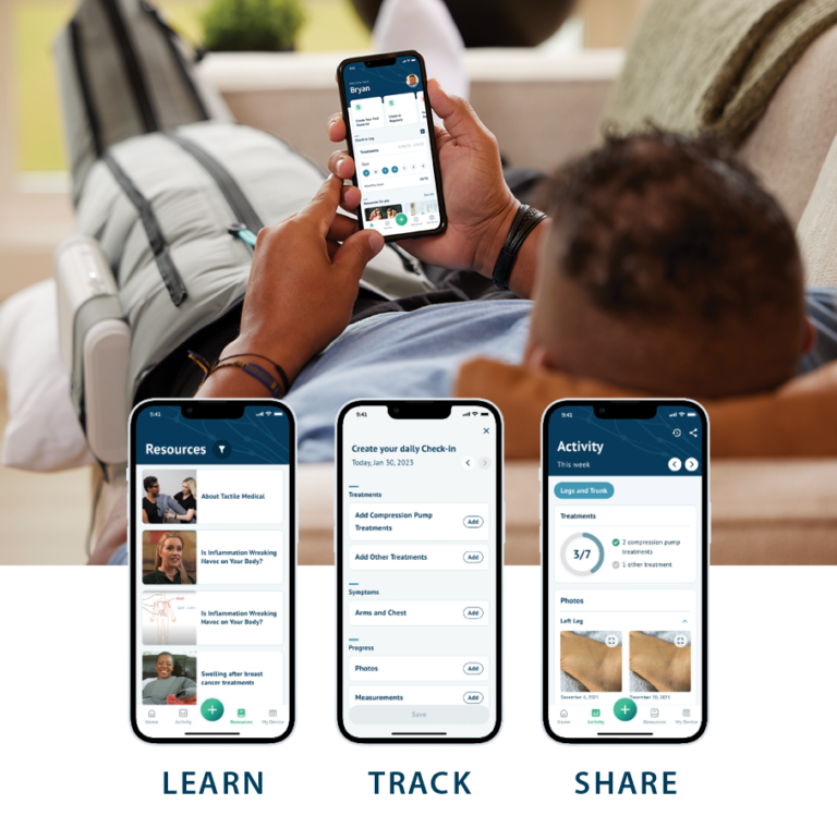 Nimbl: Pneumatic Compression Solutions for Clinicians | Tactile Medical