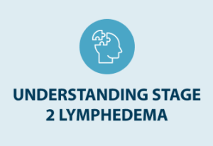Stage 2 Lymphedema: Symptoms, Causes & Treatment | Tactile Medical