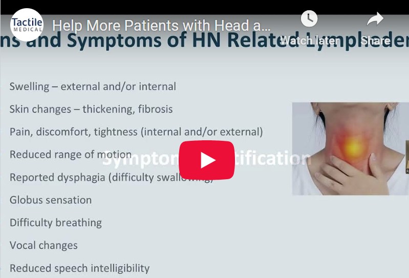 Help More Patients with Head and Neck Cancer-Related Lymphedema Find ...