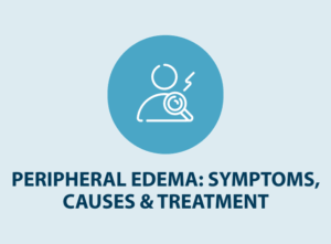 Peripheral Edema: Symptoms, Causes & Treatment | Tactile Medical